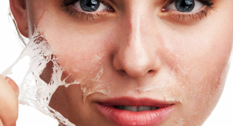 Transform Your Skin with MESOPEEL - Anti-Acne, Anti-Aging, and ... Transform Your Skin with MESOPEEL - Anti-Acne, Anti-Aging, and ...